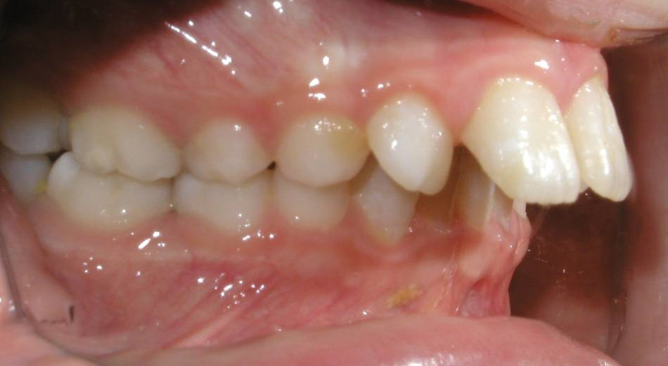 Services | Andrews Orthodontics | Orthodontist | San Carlos, CA