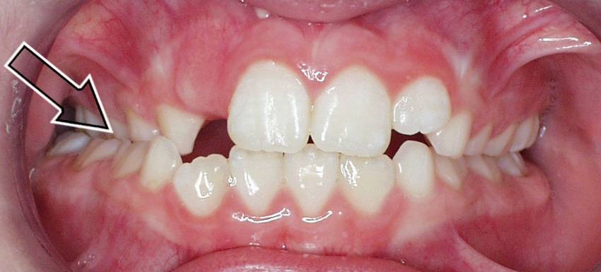 Services | Andrews Orthodontics | Orthodontist | San Carlos, CA